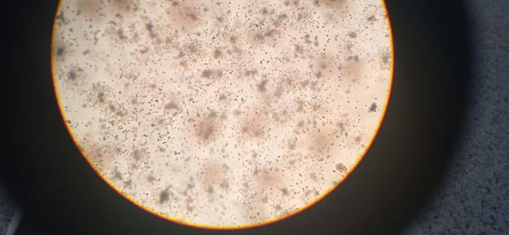 STUDY OF THE MICROBIOTA PRESENT IN STONE SAMPLES TO DETERMINE THE ...